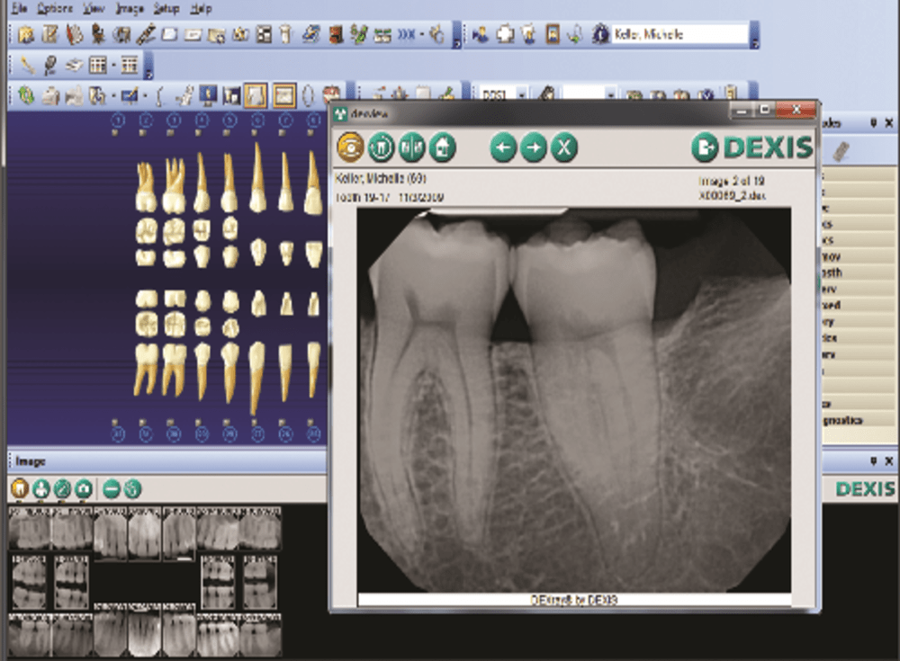 A Deep Dive into Dental EMR Software by Health Cluster